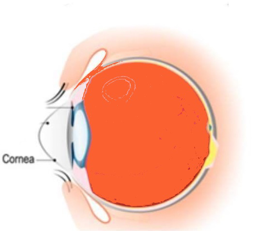 Cheratocono, sintomi, cause e cura - Orao Studio Oculistico Lecce